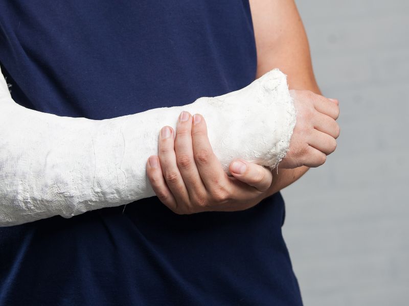 Can A Volleyball Break Your Arm Explained With Examples Volley Expert